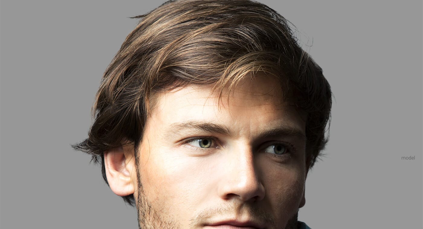 Comparing FUE and FUT - El Paso, TX - Frank Agullo, MD